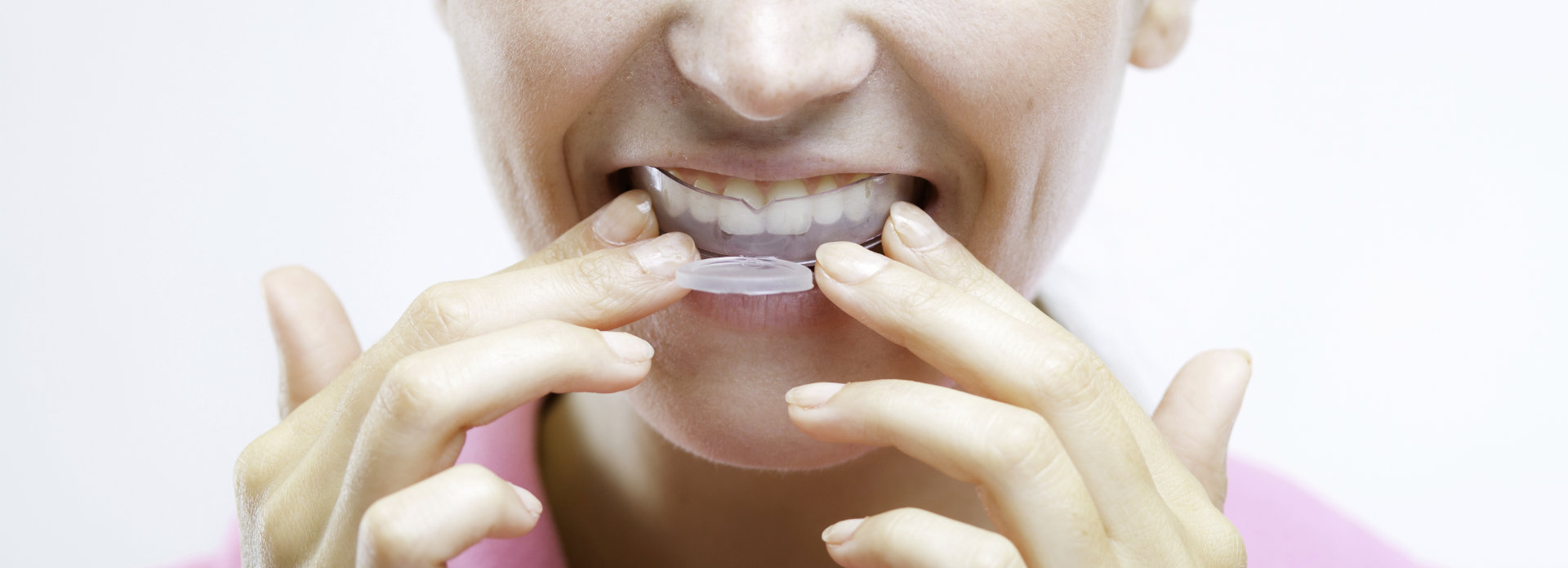 Acworth GA Nightguard Bruxism | Woodstock Teeth Grinding Treatment ...